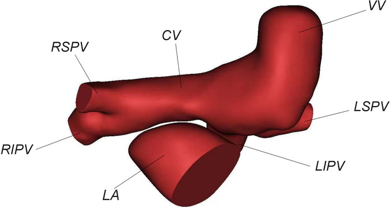 Numerical modeling assisting in surgical treatment of total anomalous ...