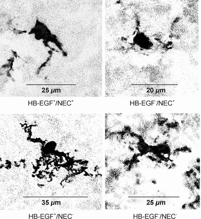 Brainstem microglial cell morphology in neonatal rats with necrotizing ...